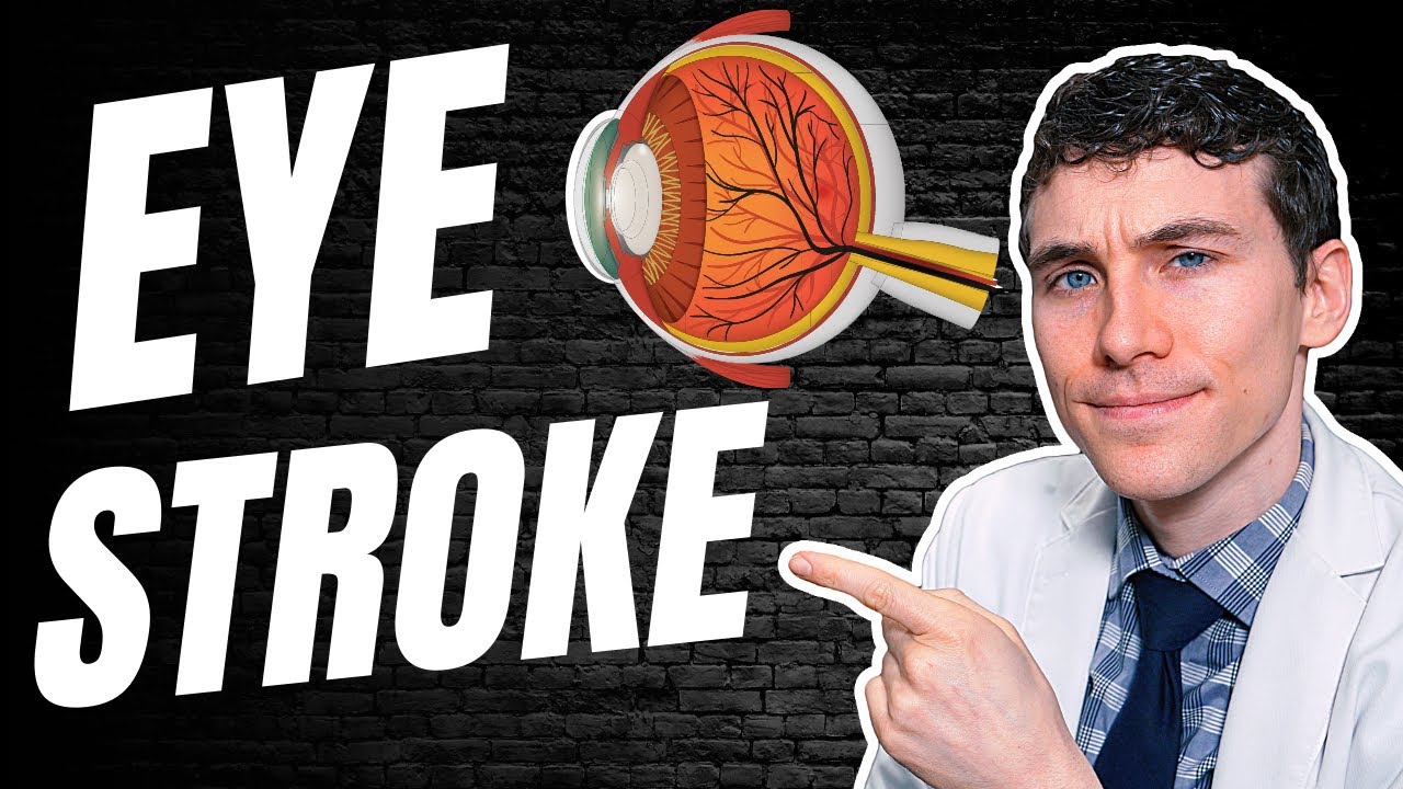 EYE STROKE Retinal Vein Occlusion Causes Symptoms Treatment 